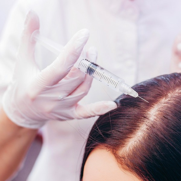 Alopécie et Perte de Cheveux - MH Clinic